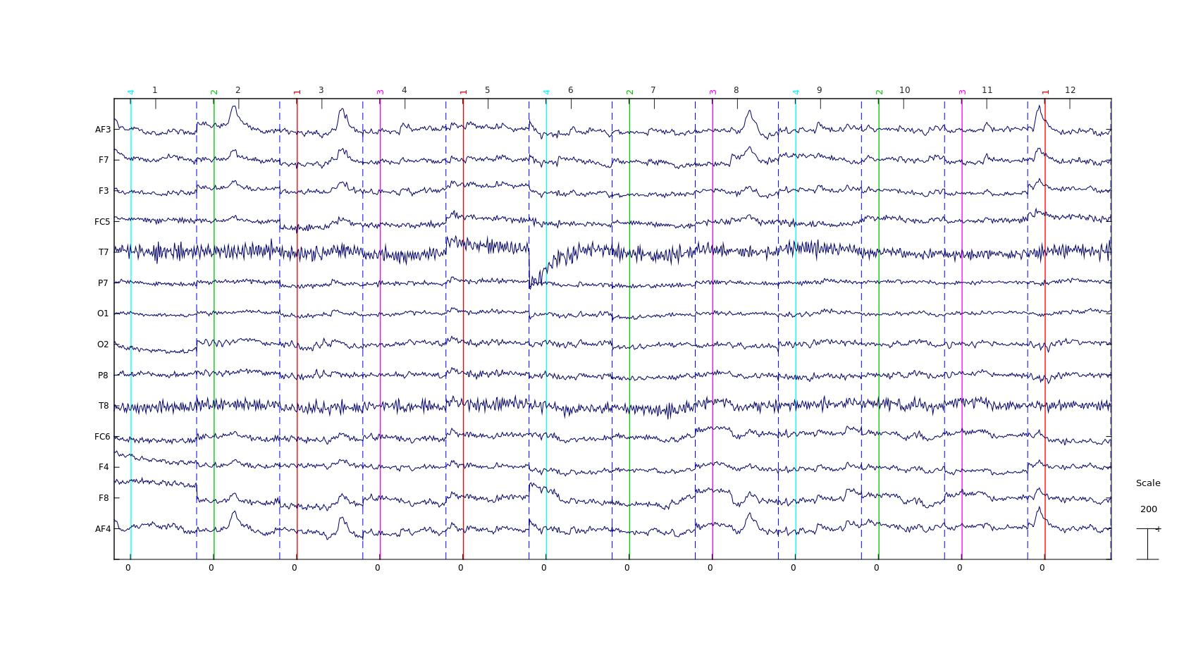 Eeg Waveform Clip Art Image Clipsafari