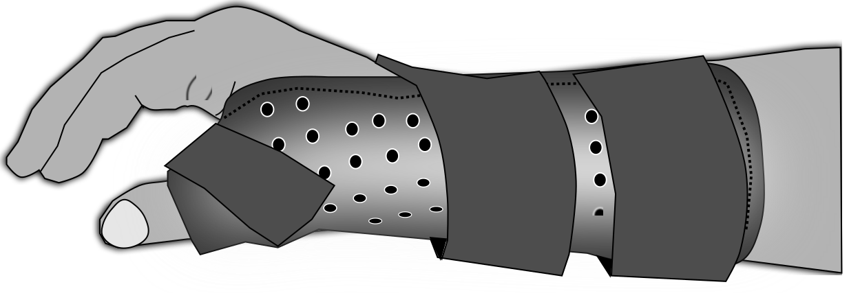 Brace Clip Art Image - ClipSafari